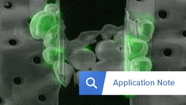 Subtomogram averaging in the cryo-ET workflow