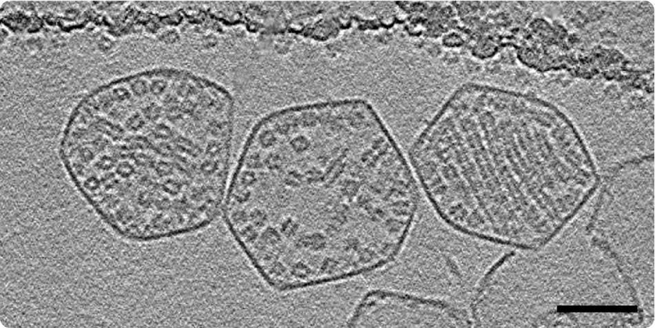 Rubisco assembly: the promise of cryo-ET for synthetic biologists