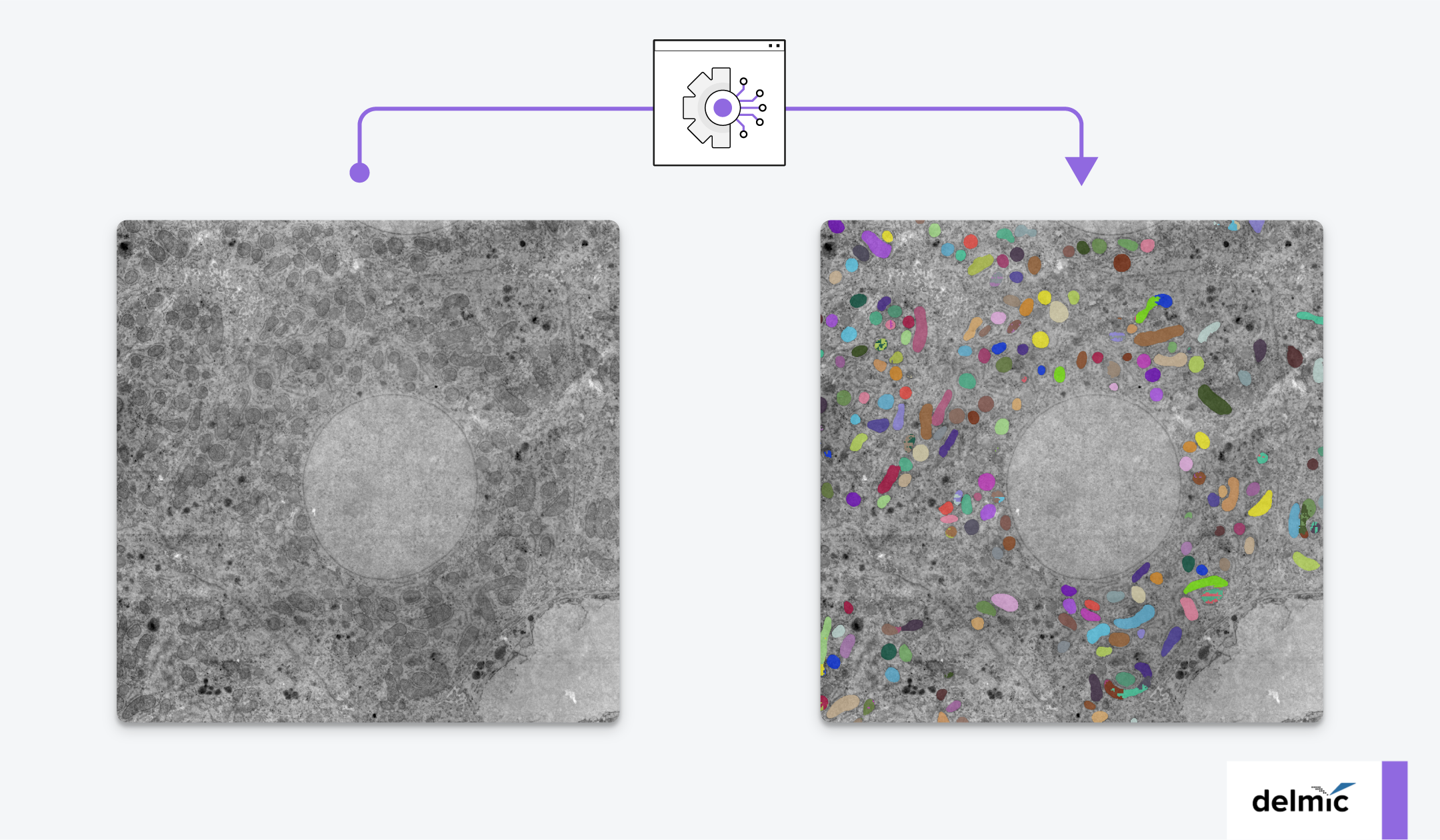 Volume Electron Microscopy: Towards Automatic Organelle Segmentation