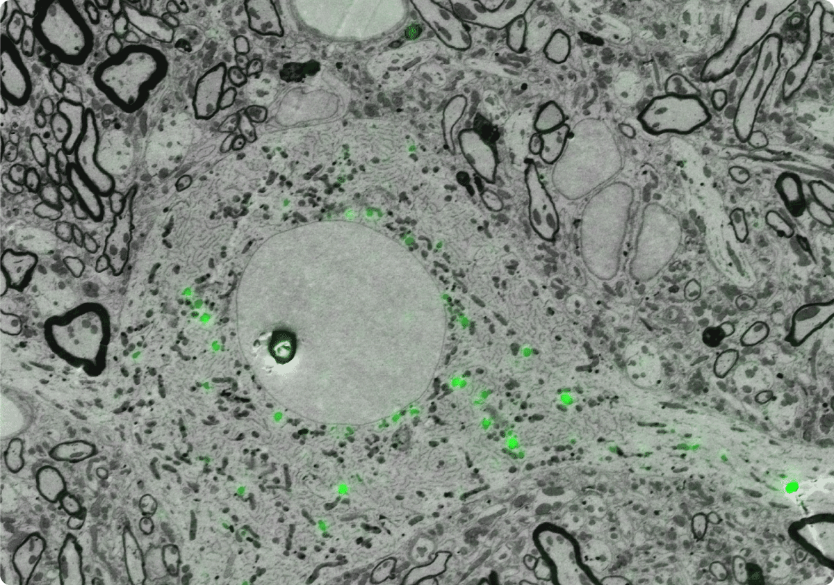 What Are The Advantages Of Cryo-Correlative Light And Electron Microscopy? What Are The Advantages Of Cryo-Correlative Light And Electron Microscopy?