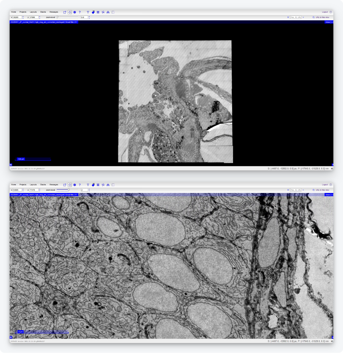 Increasing the throughput of volume electron microscopy with FAST-EM
