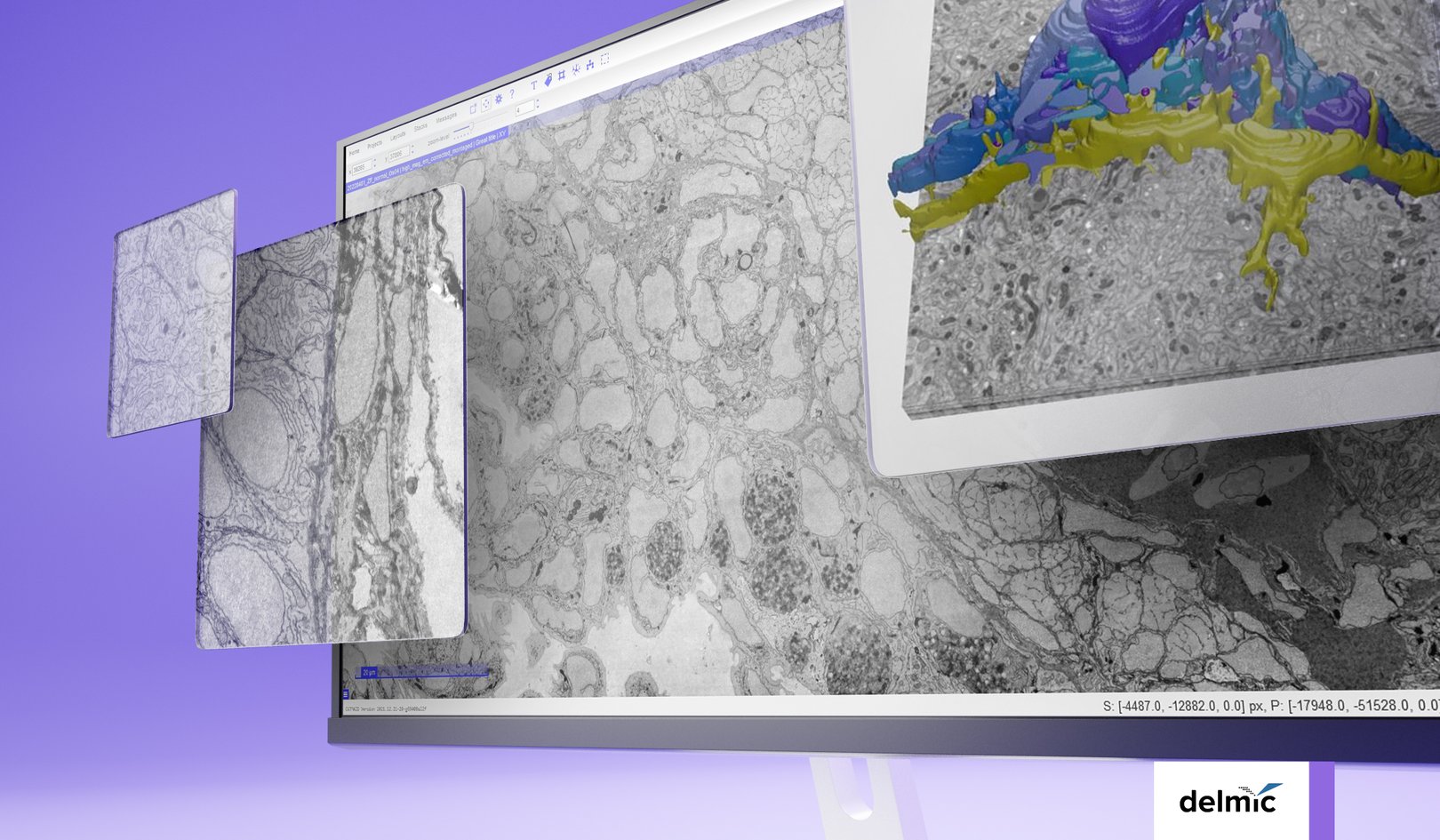 Increasing the throughput of volume electron microscopy with FAST-EM