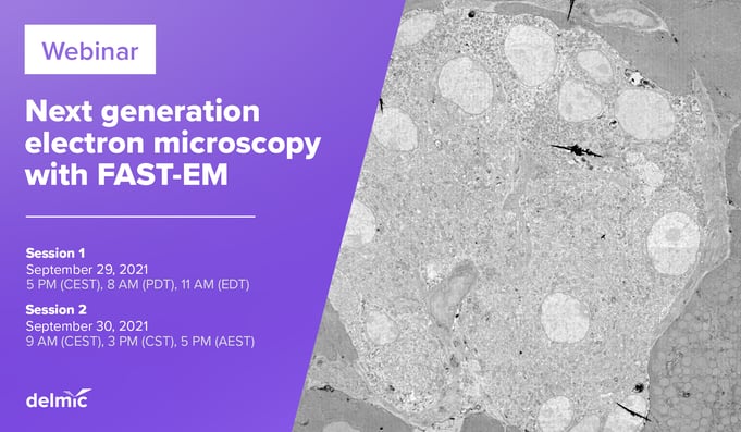 Unlocking the potential of CLEM with high-throughput electron microscopy