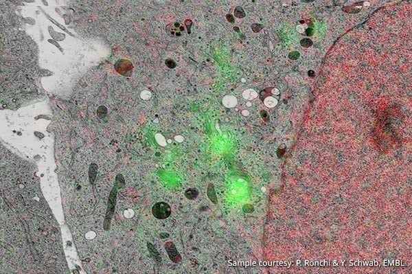 Super-resolution correlative microscopy: The perfect combination of ...