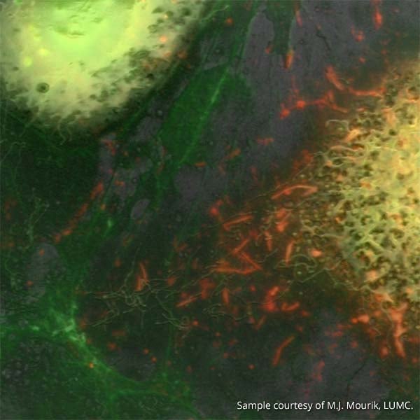 New research on imaging live cells with correlative light and electron ...