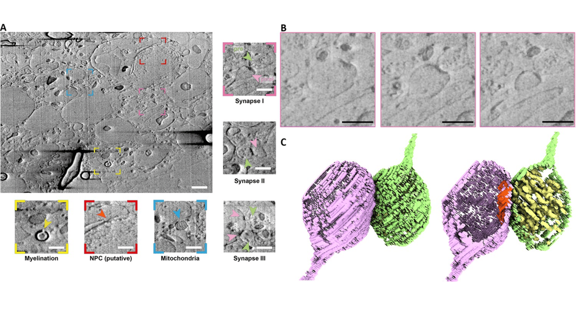 What is the difference between cryo-EM and cryo-ET?